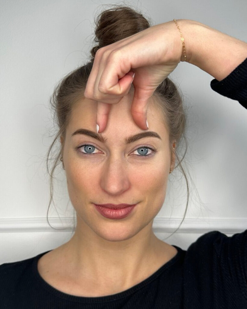 Do's and Don'ts After Botox Injections | beautyflymedical.com